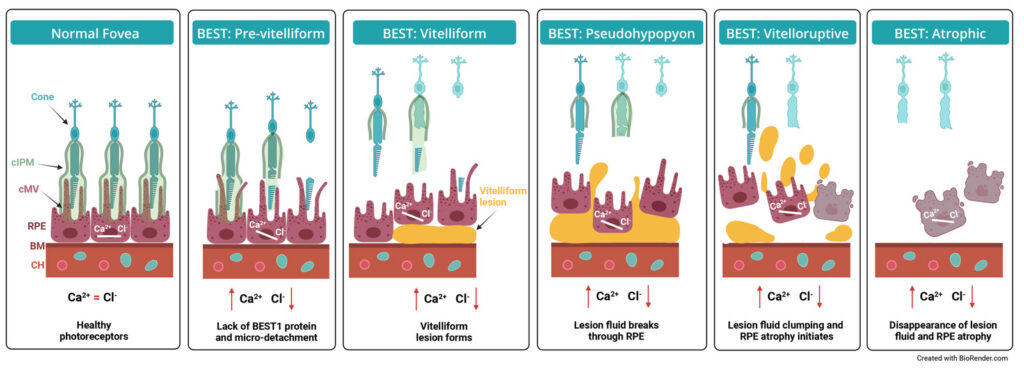 IRD Programs - Opus Genetics